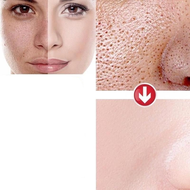 Salicylic Acid Ice Cream Mask – Vesarya